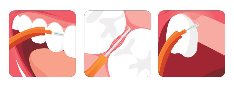 Brossettes interdentaires - 6 tailles